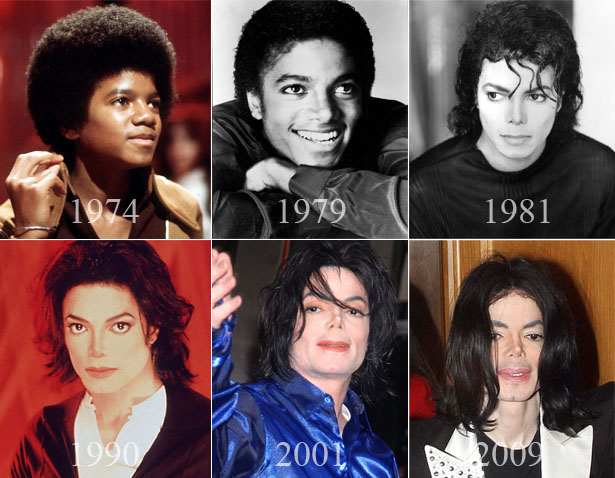 michael-jackson-amazing-plastic-surgery-transformation-timeline-107582